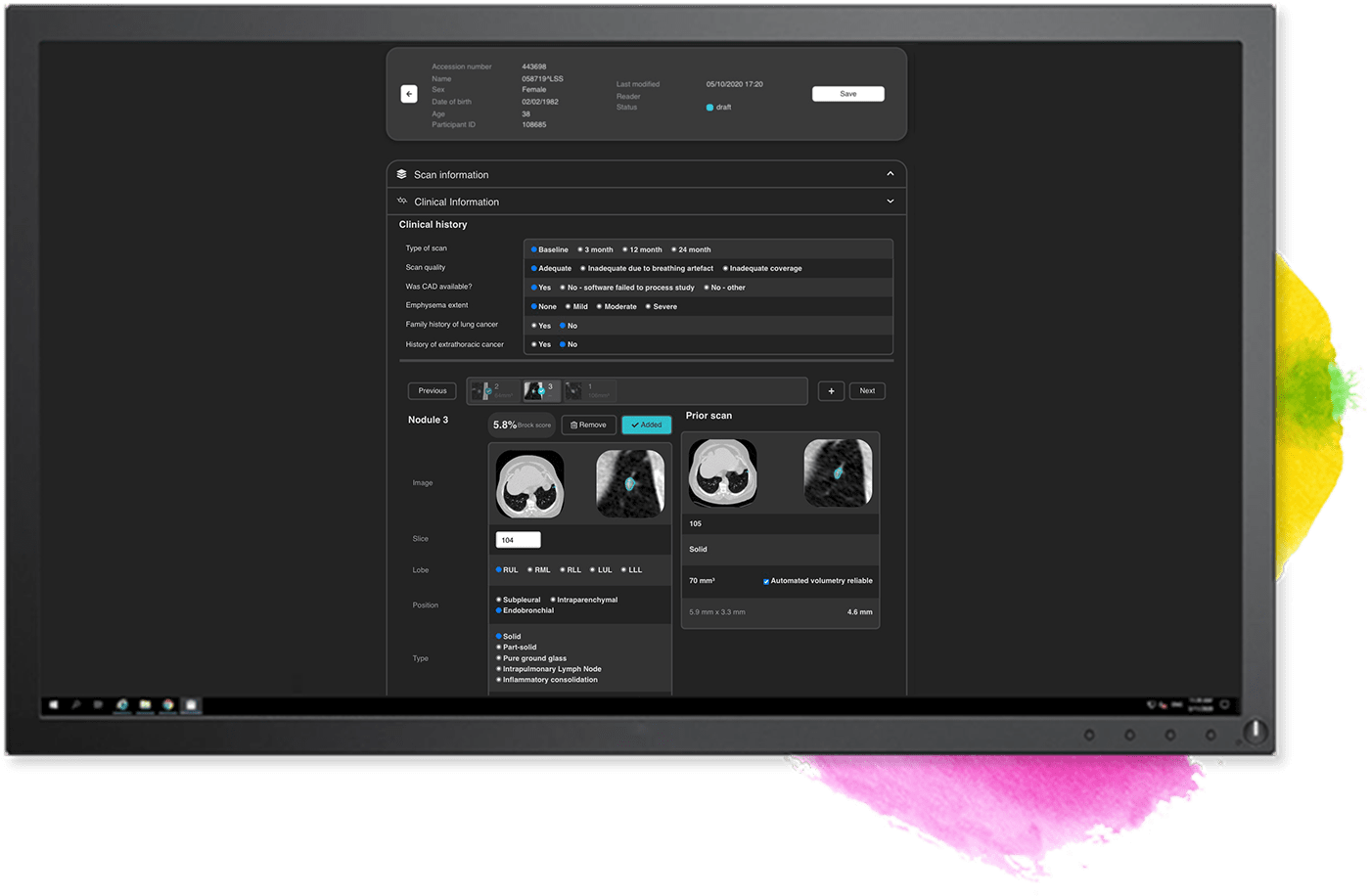 Veye Reporting - Aidence