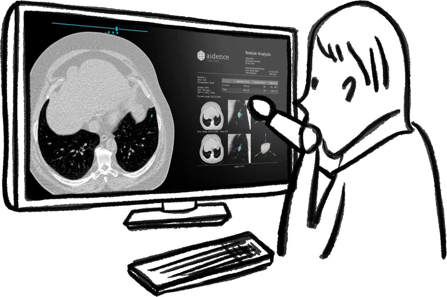 Three articles about Veye Lung Nodules in Dutch radiology magazine ...